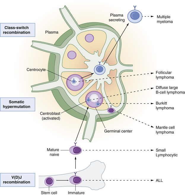 Lymphoproliferative Disorders | Ento Key