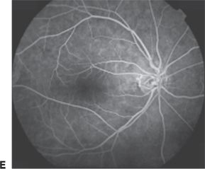 Normal Anatomy of the Macula | Ento Key