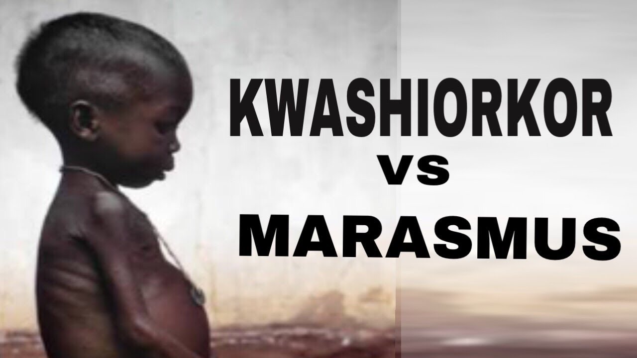 Health - Example Of Anything