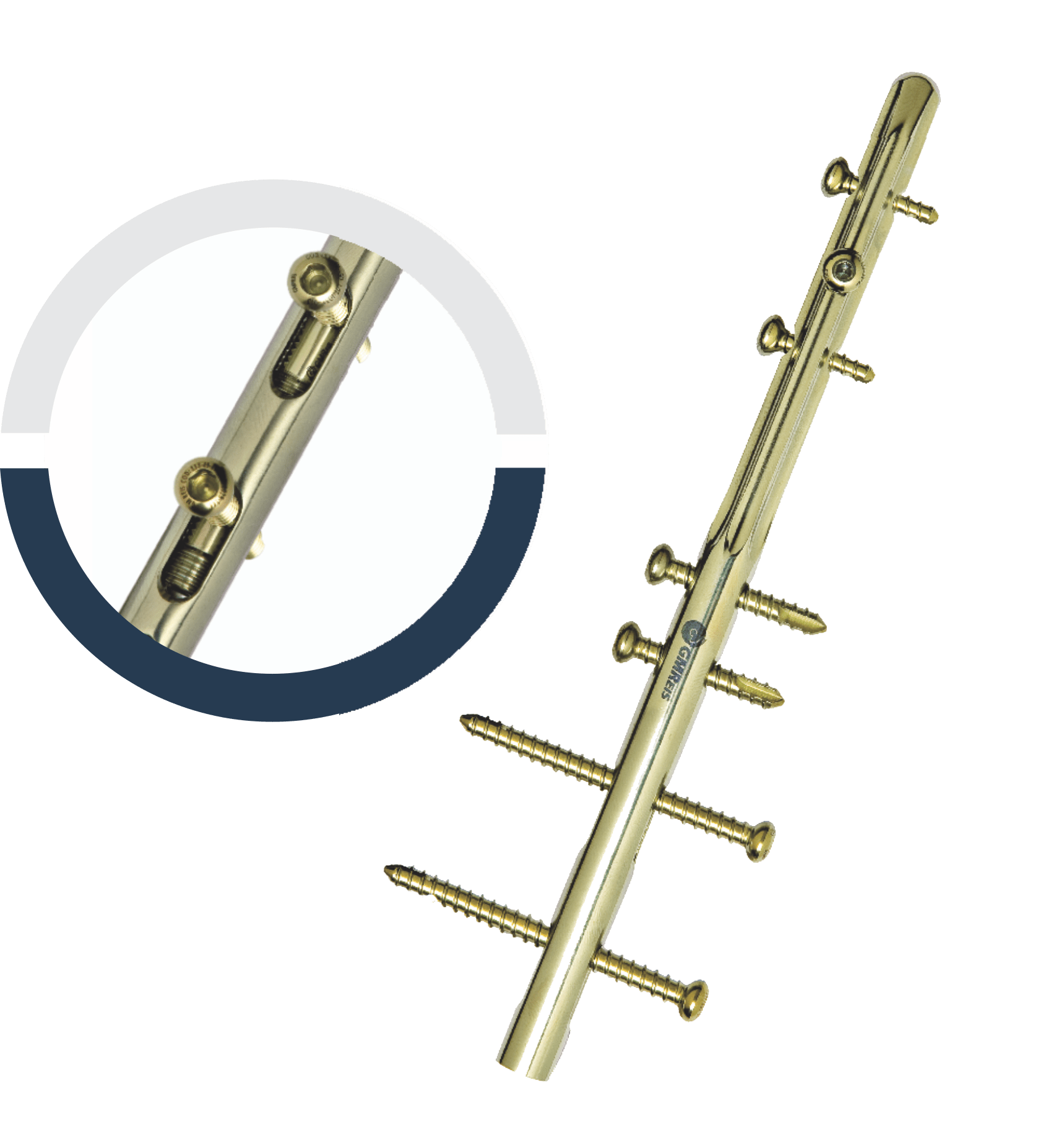 RETROFIX - Haste Bloqueada Tibiotársica - GMReis