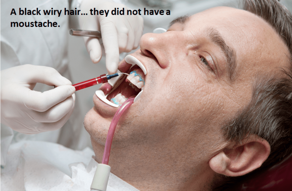 List of the grossest things dentists have found in patients' mouths ...
