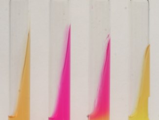 Triple Sugar Iron Agar (TSI): Principle, Procedure and Interpretation ...