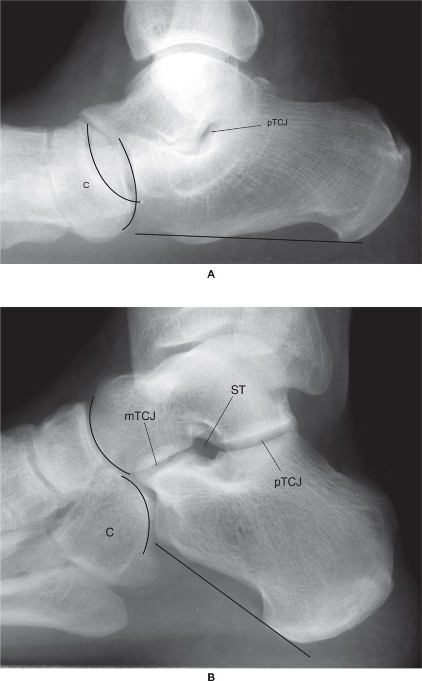 6: Normal Variants and Anomalies | Musculoskeletal Key