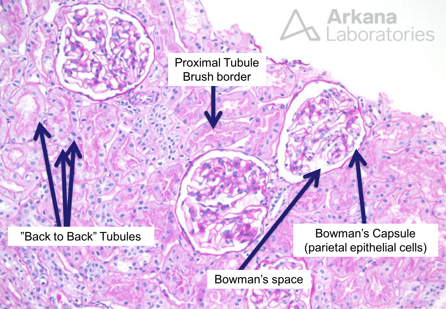 Path 101 – NephSim