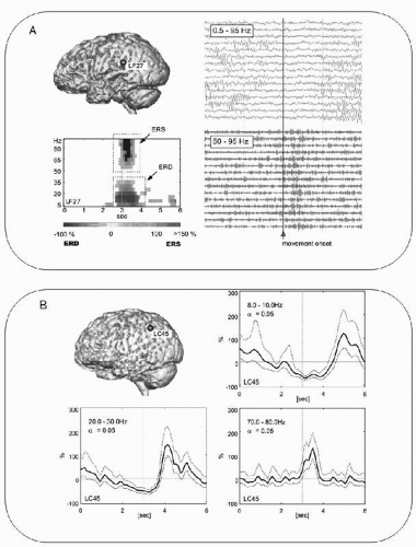Eeg Event Related Desynchronization Erd And Event Related