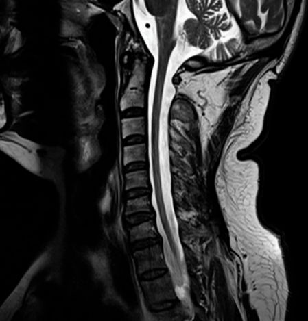Pitfalls in diagnosing cerebral parenchymal disease | Neupsy Key