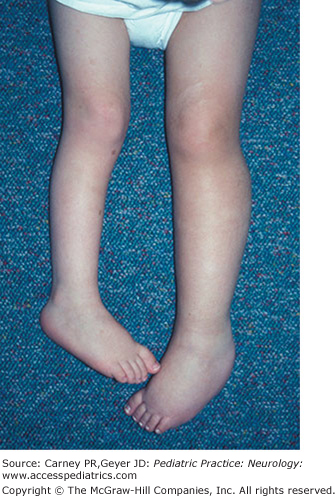 Neurocutaneous Syndromes | Neupsy Key