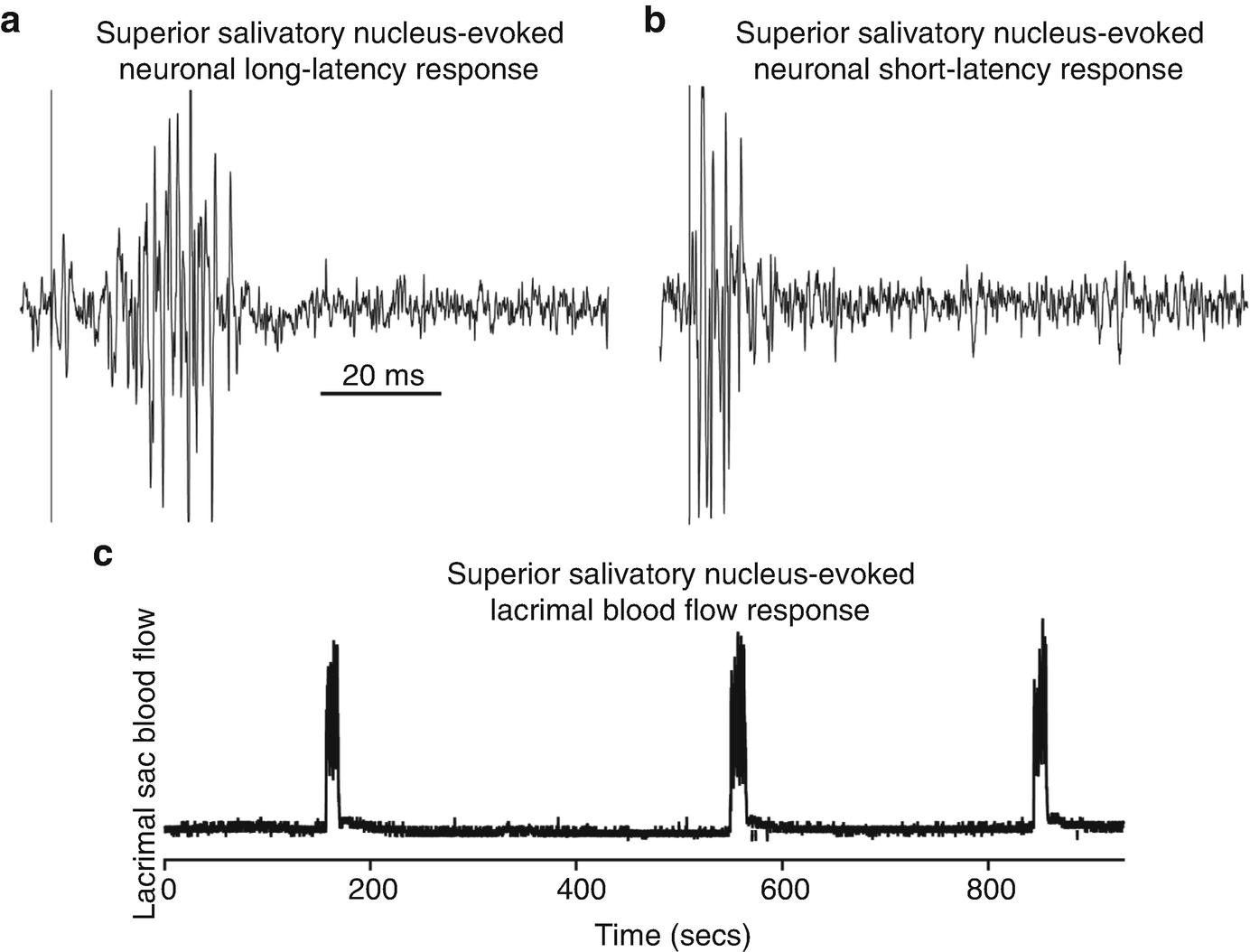 Models for Trigeminal Autonomic Cephalalgias | Neupsy Key