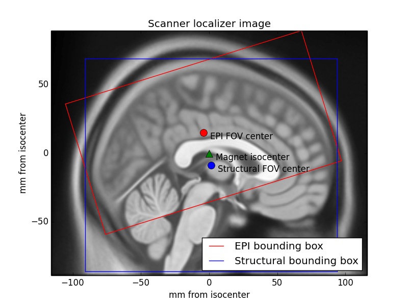 Brain Imaging Png : What Is Fmri Center For Functional Mri Uc San Diego ...