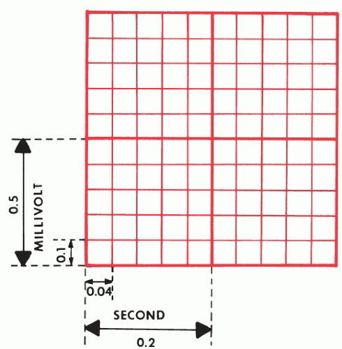 Electrocardiography | Nurse Key
