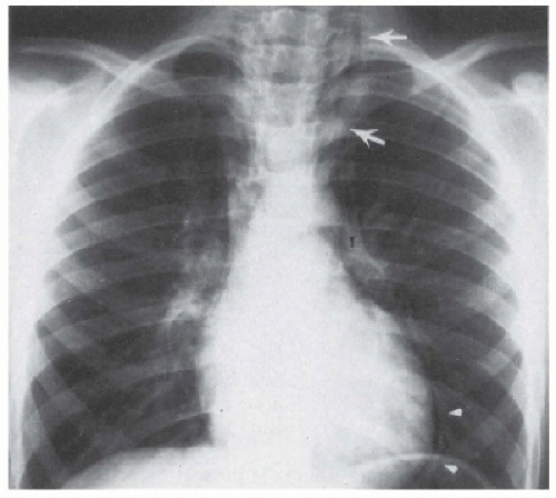 Pulmonary Disorders | Nurse Key
