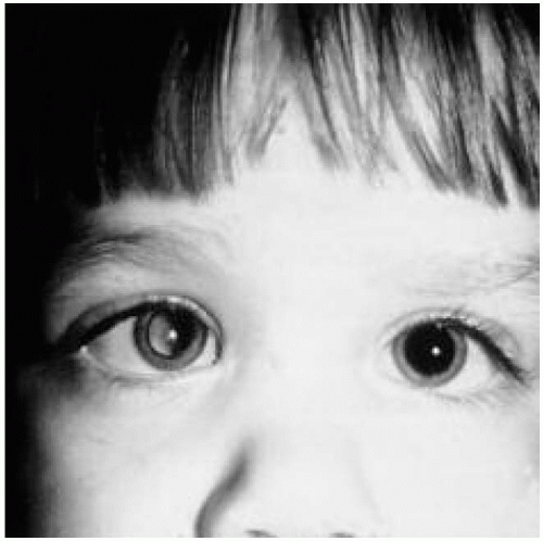 Ophthalmology Overview | Obgyn Key