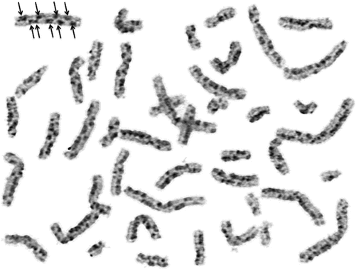 Other Well-Defined Immunodeficiencies | Obgyn Key