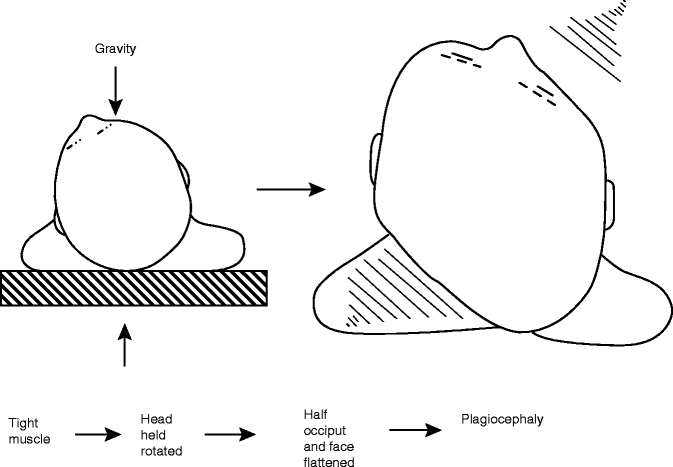 The Neck | Obgyn Key
