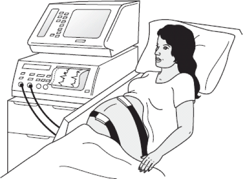 Intrapartum Electronic Fetal Monitoring | Obgyn Key