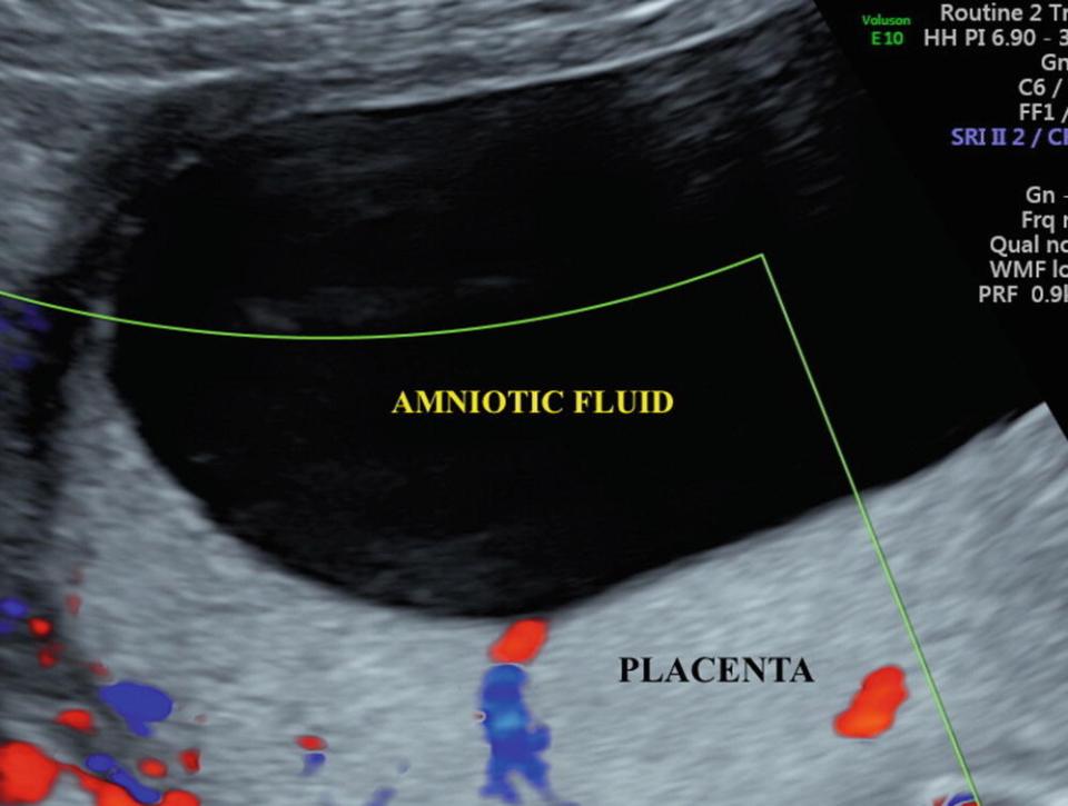 and Probe Setting | Obgyn Key