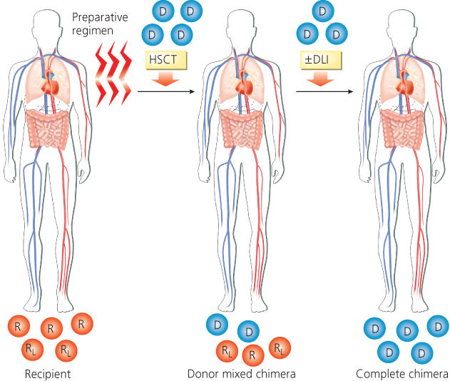 Hematopoietic cell transplantation | Oncohema Key