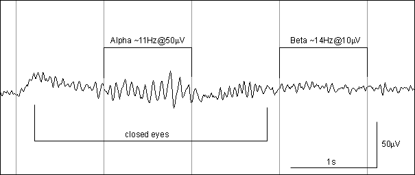 Eeg Circuit Block Diagram