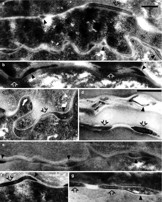 Influence of Excipients on Two Elements of the Stratum Corneum Barrier ...