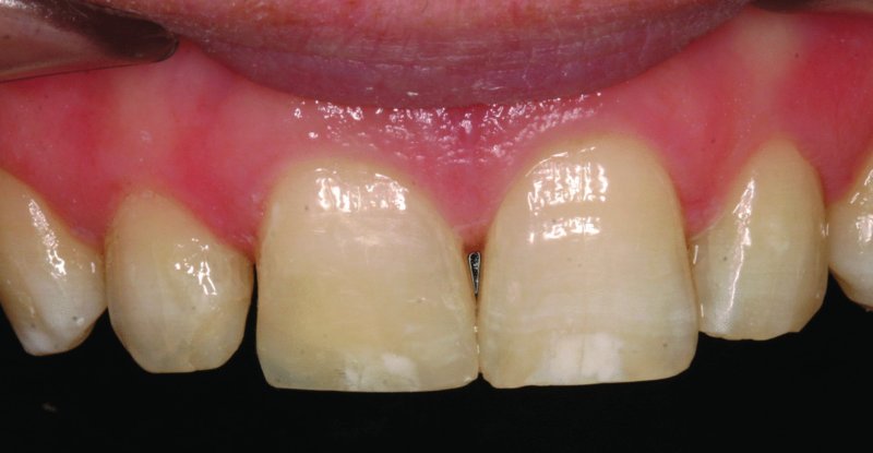Clinical Photography | Pocket Dentistry