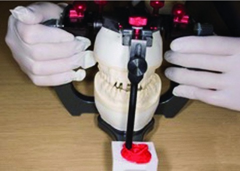 Semi-adjustable Articulators | Pocket Dentistry