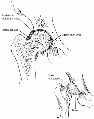 Arthrogram Hip Radiology Key
