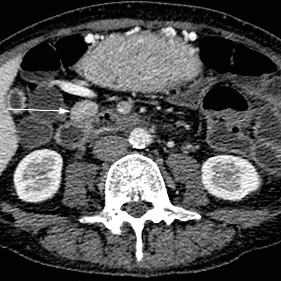 Stomach | Radiology Key