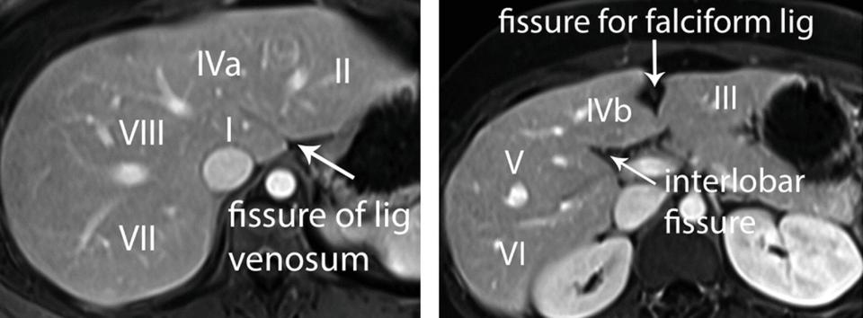 Liver Radiology Key