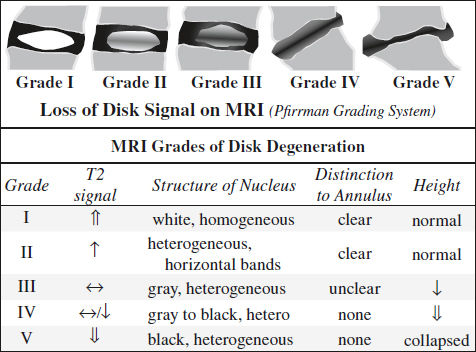 and Spine Disorders | Radiology Key