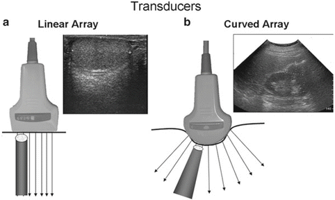 Maximizing Image Quality: User-Dependent Variables | Radiology Key
