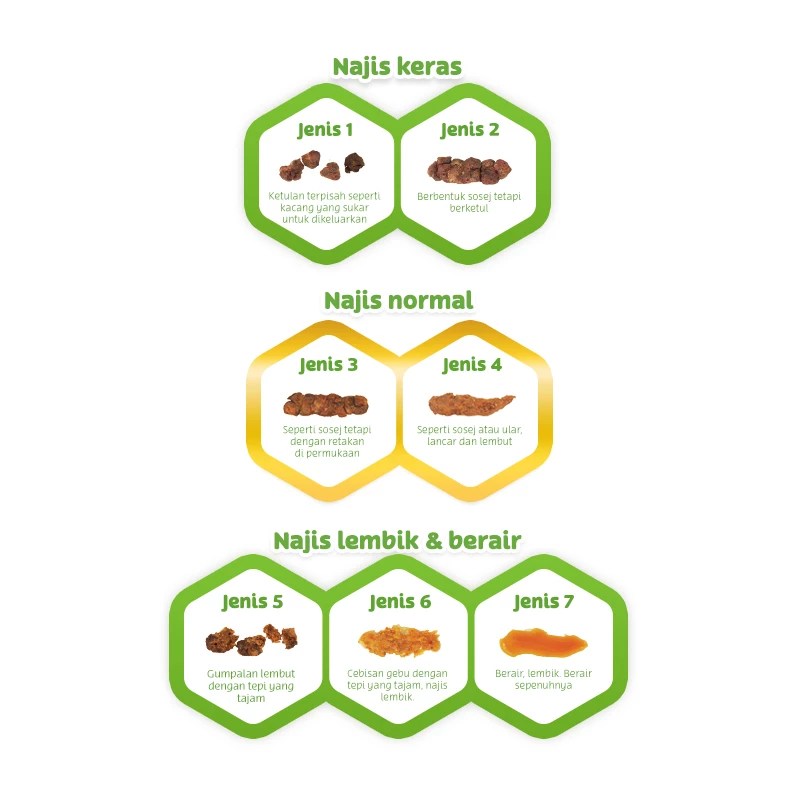 Hijau Warna Najis Bayi Dan Tahap Kesihatan / Qzv0 I89f0deem - Tahlia ...