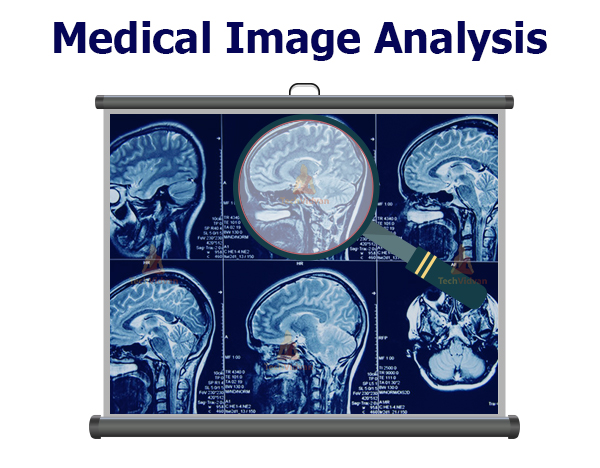 Data Science In Healthcare 6 Must Read Use Cases Techvidvan