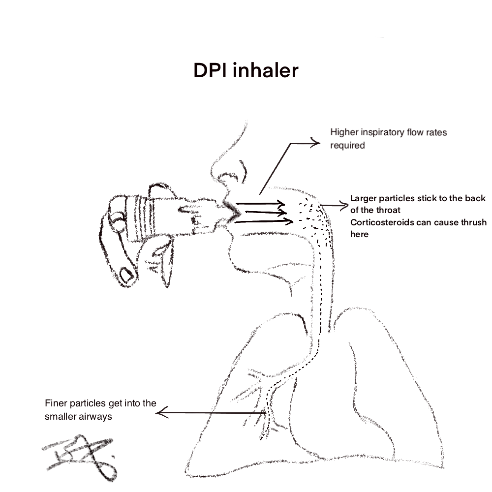 Inhaler devices: How do you choose? - The Med Book