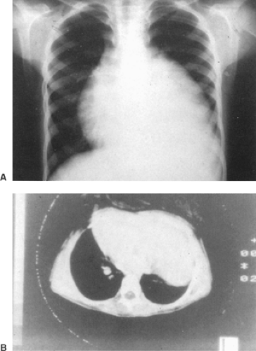 The Thymus | Thoracic Key