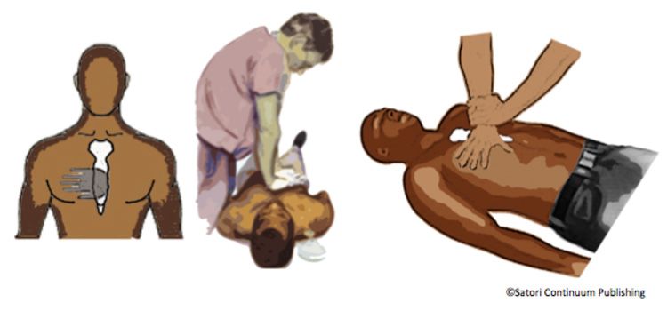 Life Support | Thoracic Key