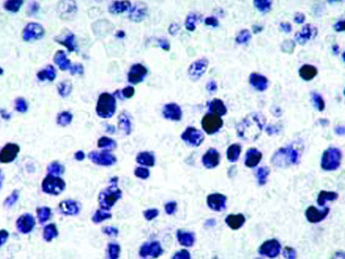 ZytoFast Chromogenic in situ Hybridization (CISH) Probes and Kits - Bio SB