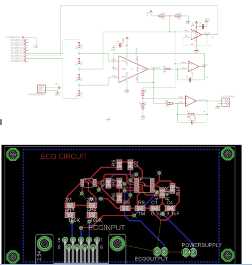 Ecg Schematic Diagram