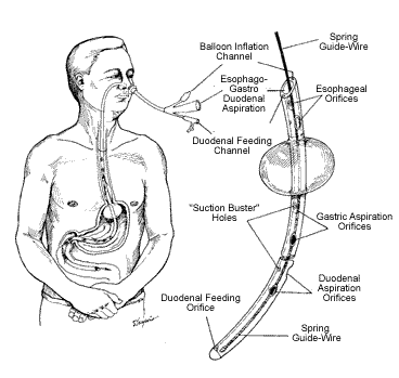 Mark IV Nasal Tube Details – Moss Tubes, Inc.