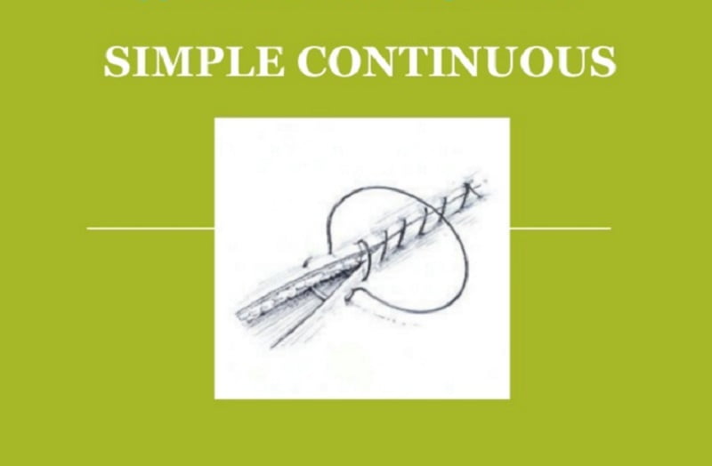 Simple Continuous Suture Pattern - Veterinary Discussions