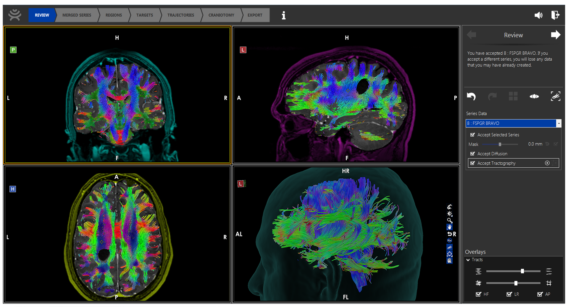 How Synaptive Medical is Transforming Neurosurgery